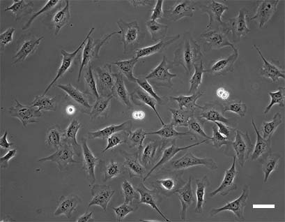 LIVECell for AI-assisted cell segmentation