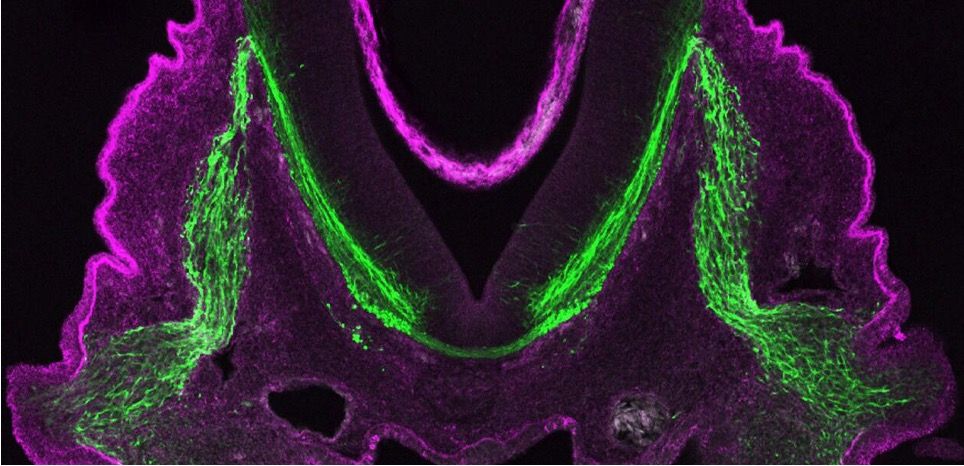 Discerning the different types of microscopy in biomedical research