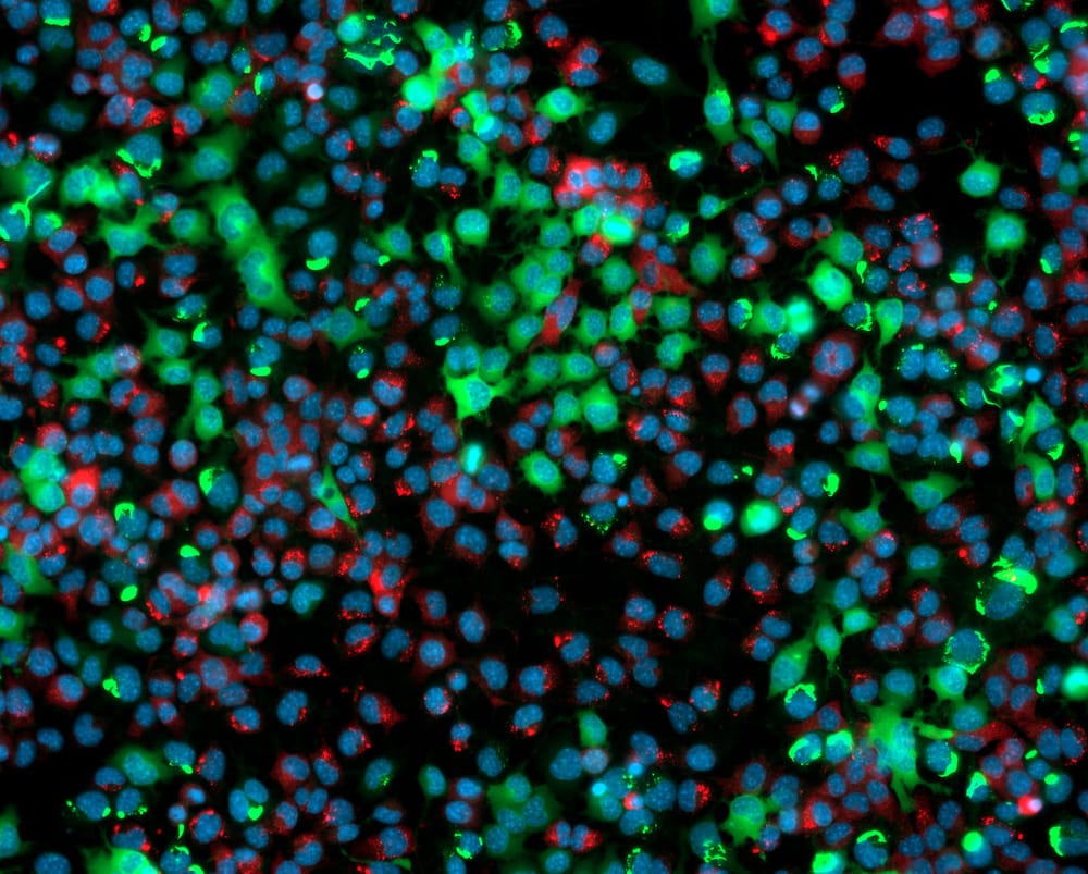 Open-source microscopy tools for image processing and analysis