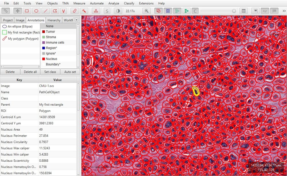 Open-source microscopy tools for image processing and analysis