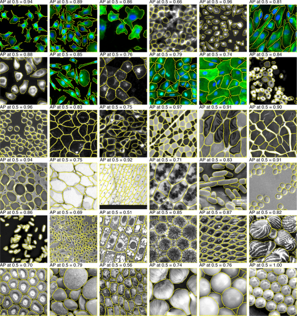 LIVECell for AI-assisted cell segmentation